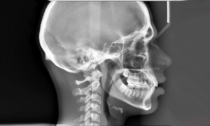 Tele radiografia - Easy Radiologia