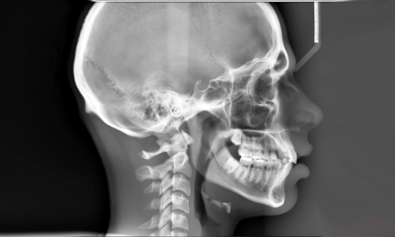 Tele radiografia - Easy Radiologia